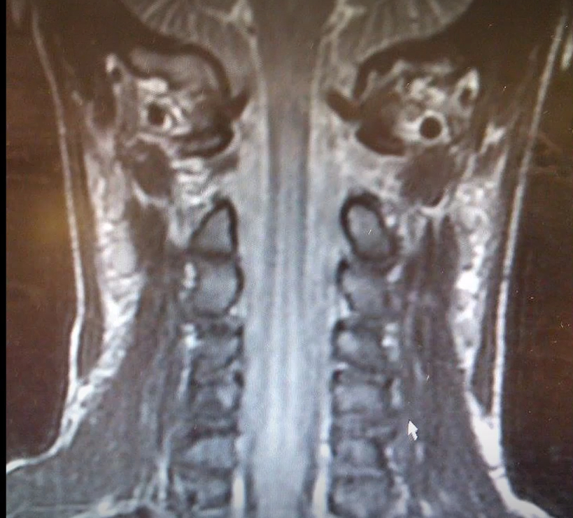 What and Who Killed Colton Berrett? – jameslyonsweiler.com